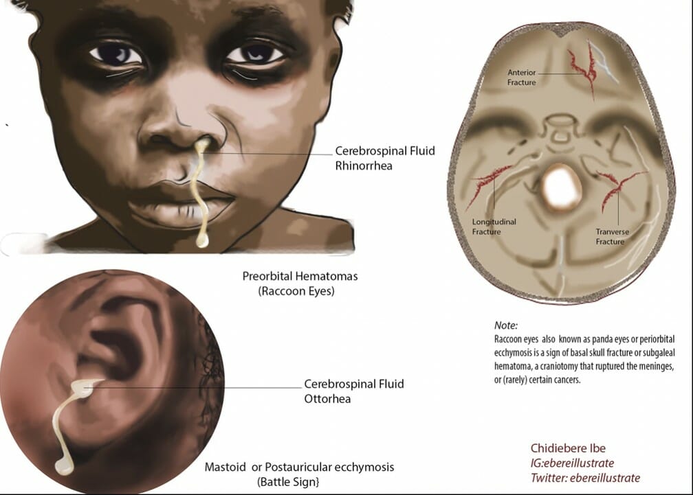 Ilustração de mãe e feto negros viraliza: conheça o estudante de ...